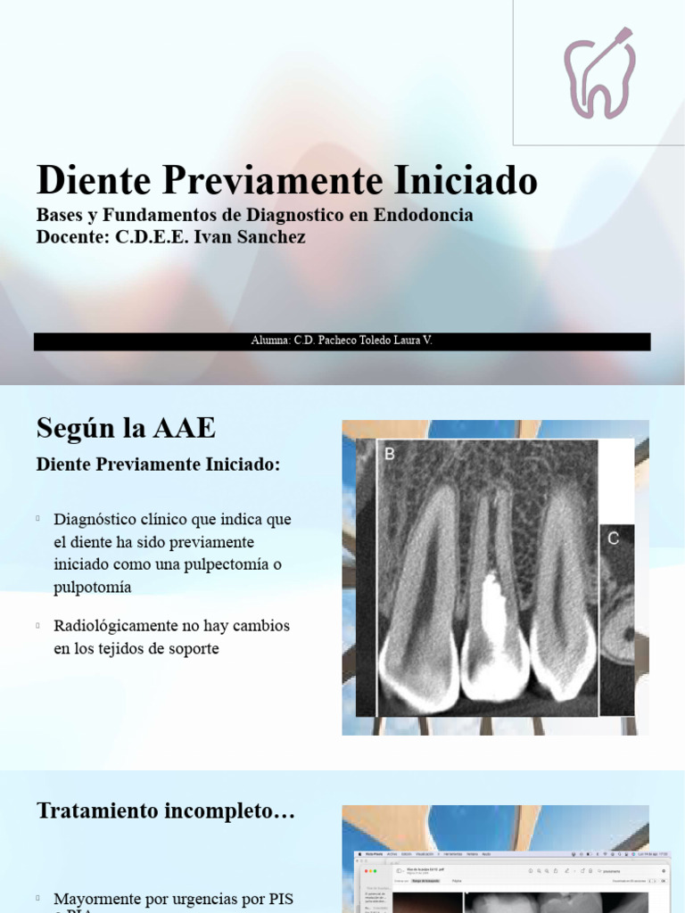 Diente Previamente Iniciado | PDF
