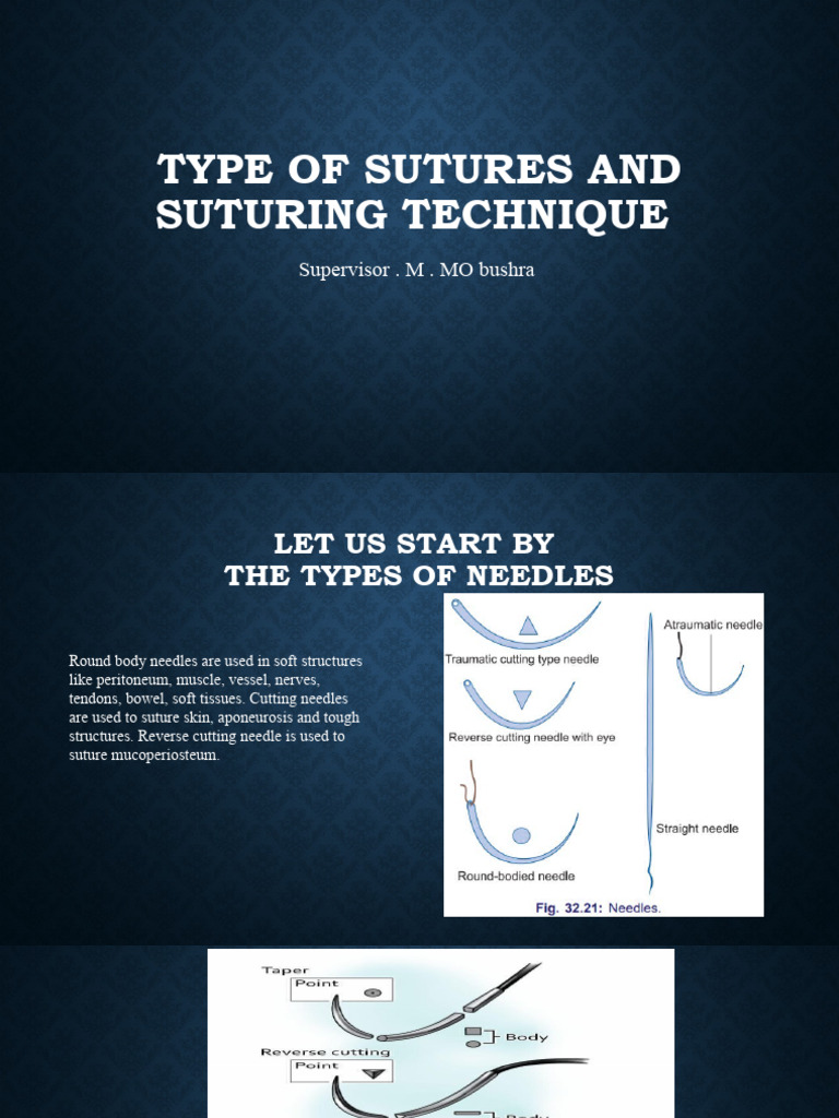 Type of Sutures and Suturing Technique | PDF | Surgical Suture | Wound