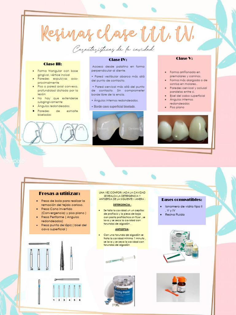 Resinas Clase III, IV y V | PDF | Esmalte de dientes | Grabado