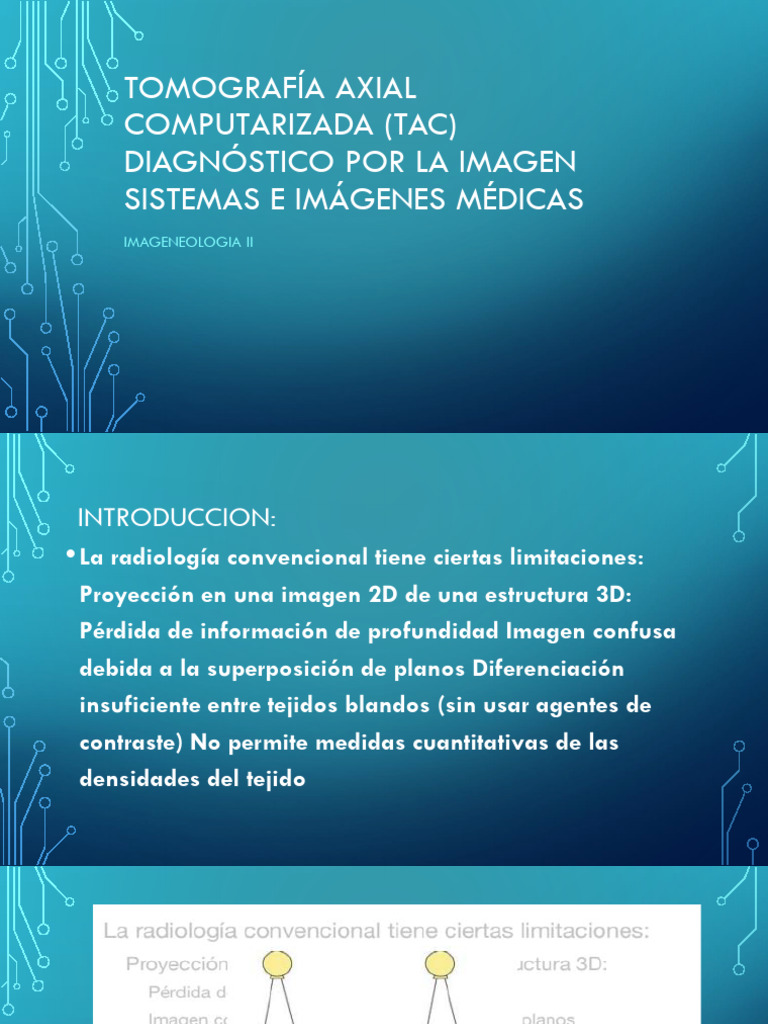 Tomografía Axial Computarizada (TAC) | PDF | Ct Scan | Especialidades ...