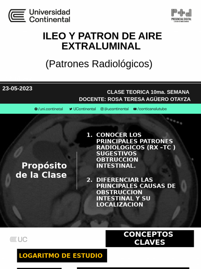 Ileo y Aire Extraluminal en Radiografías | PDF | Abdomen | Intestino grueso