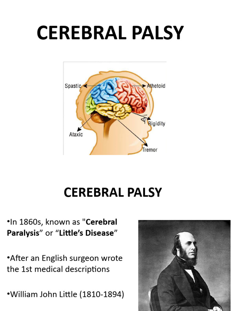 Cerebral Palsy | PDF | Cerebral Palsy | Neurology