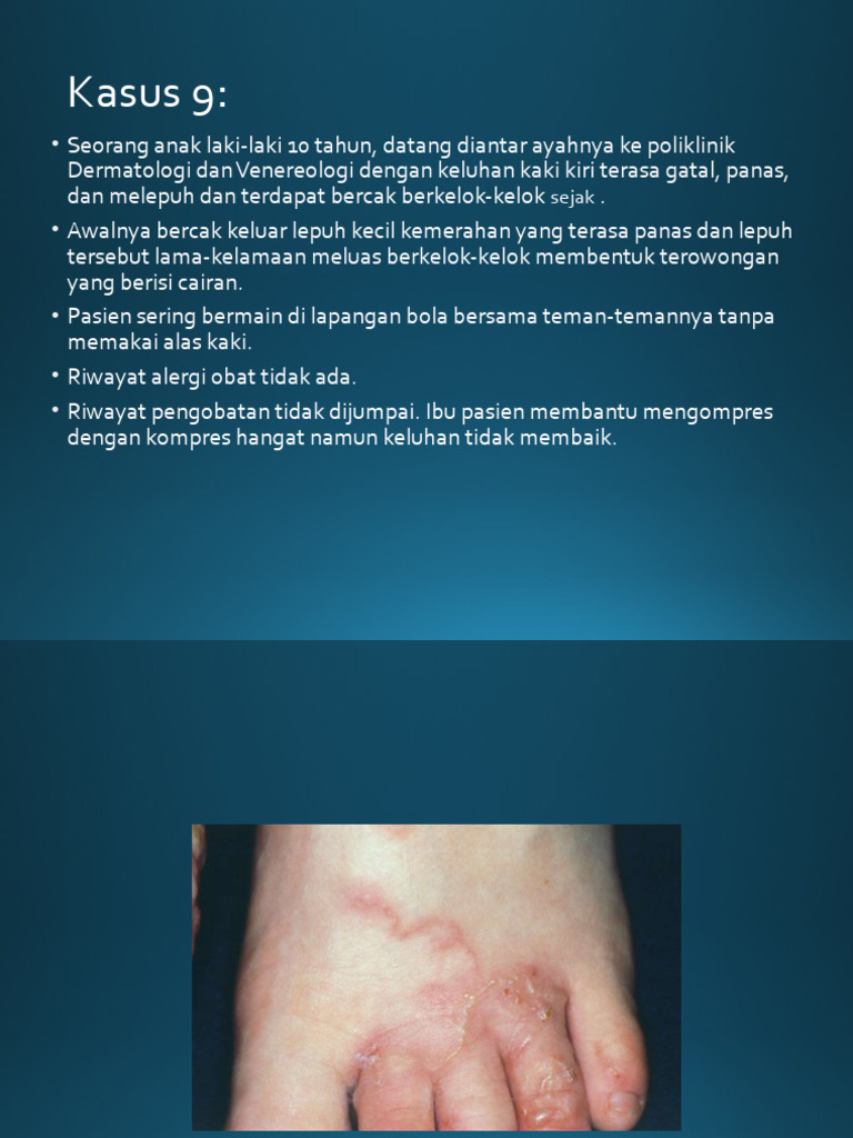 Creeping Eruption | PDF