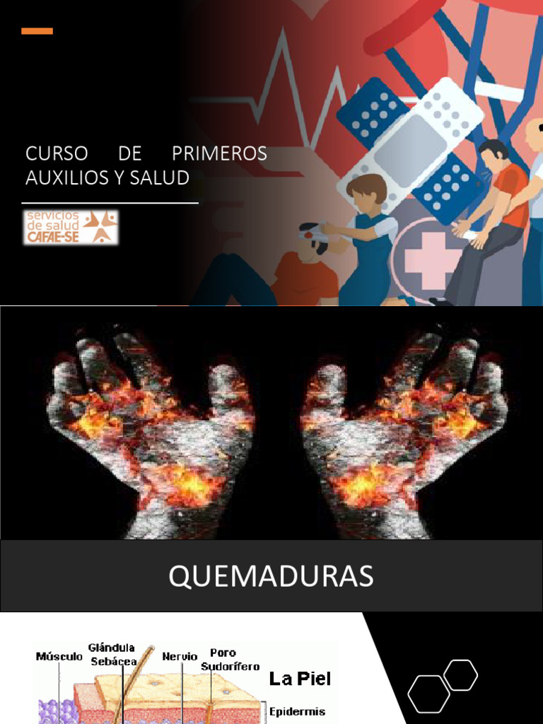 Quemaduras | PDF | Quemar | Primeros auxilios