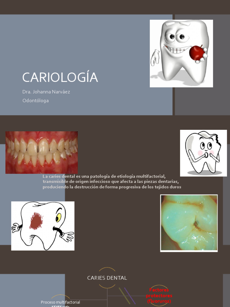 Clasificación y Diagnóstico de Caries Dental | PDF | Diente | Esmalte ...
