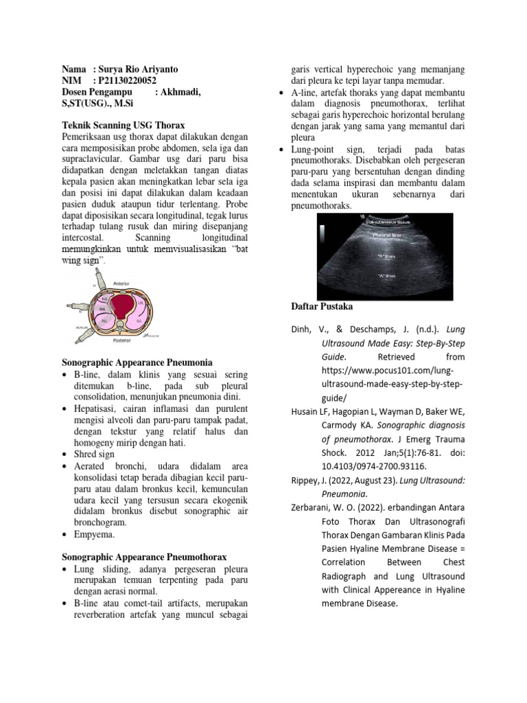 USG Thorax - Poltekkes Kemenkes Jakarta 2 Prodi D4 Teknik Radiologi ...