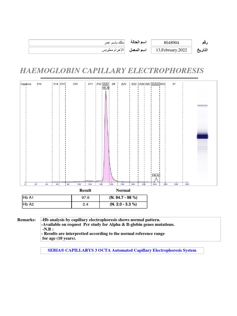 HAEMOGLOBIN - CAPILLARY - ELECTROPHORESIS - ملك باسم عمر - 8048904 | PDF