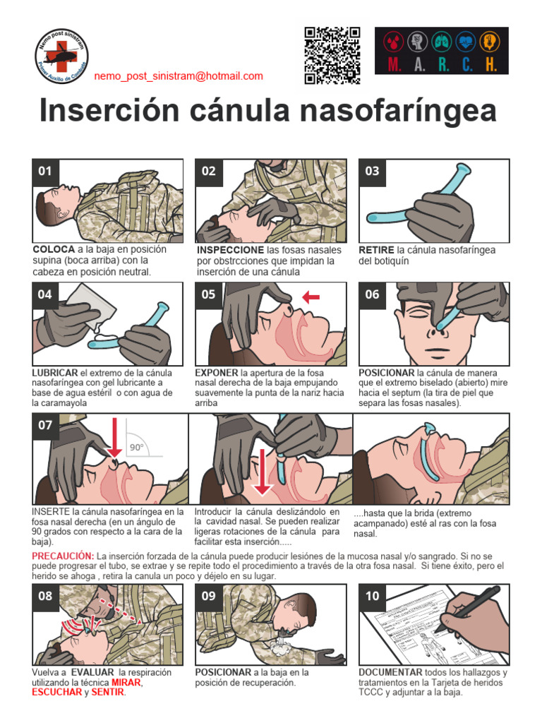 Inserción Cánula Nasofaríngea | PDF | Anatomía humana ...
