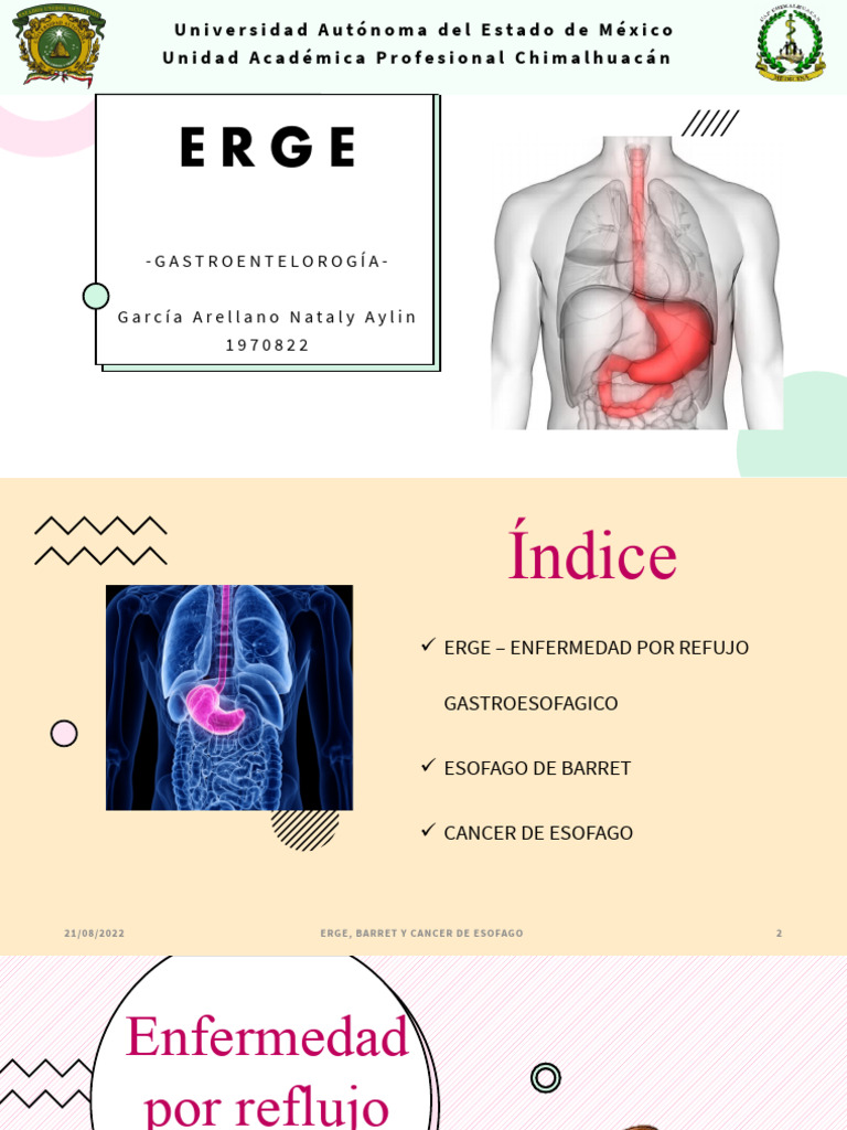 Erge | PDF | La enfermedad por reflujo gastroesofágico | Esófago