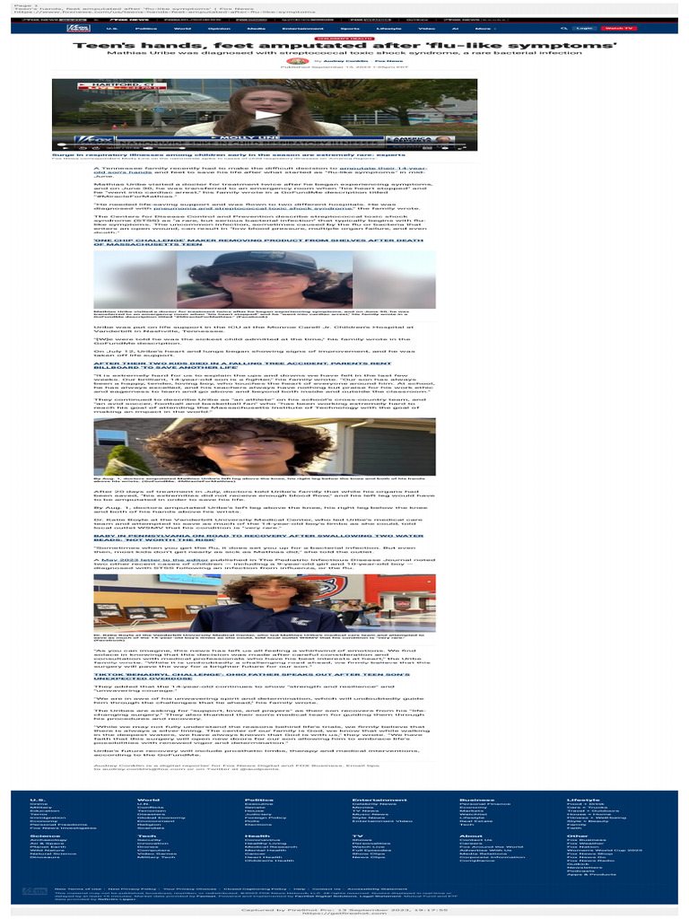 Teen's Hands, Feet Amputated After 'Flu-Like Symptoms' - Fox News | PDF ...