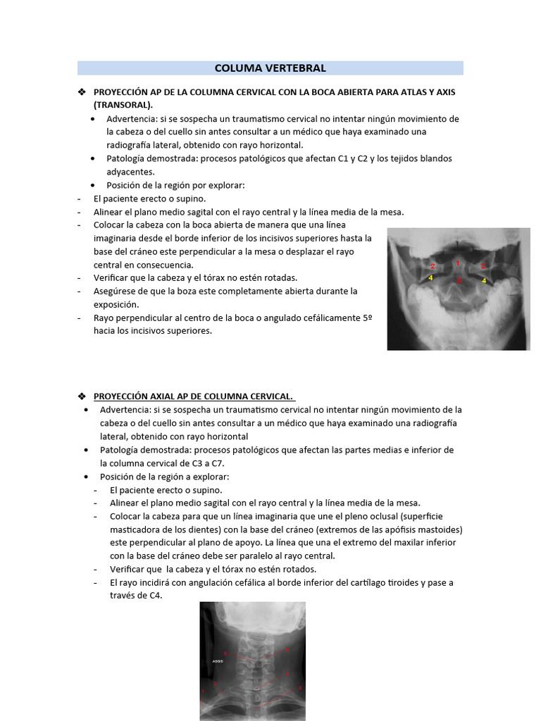 Columa Vertebral, Dorsal, Lumbas, Sacra | PDF | La columna vertebral ...