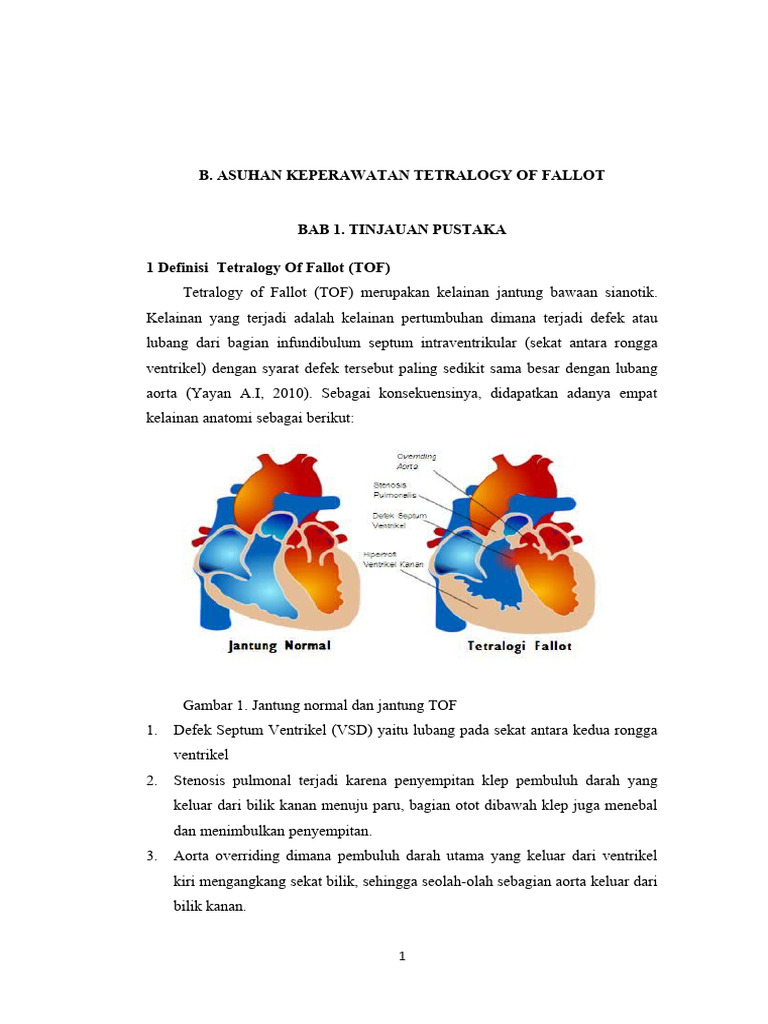 Asuhan Keperawatan Tetralogy of Fallot | PDF