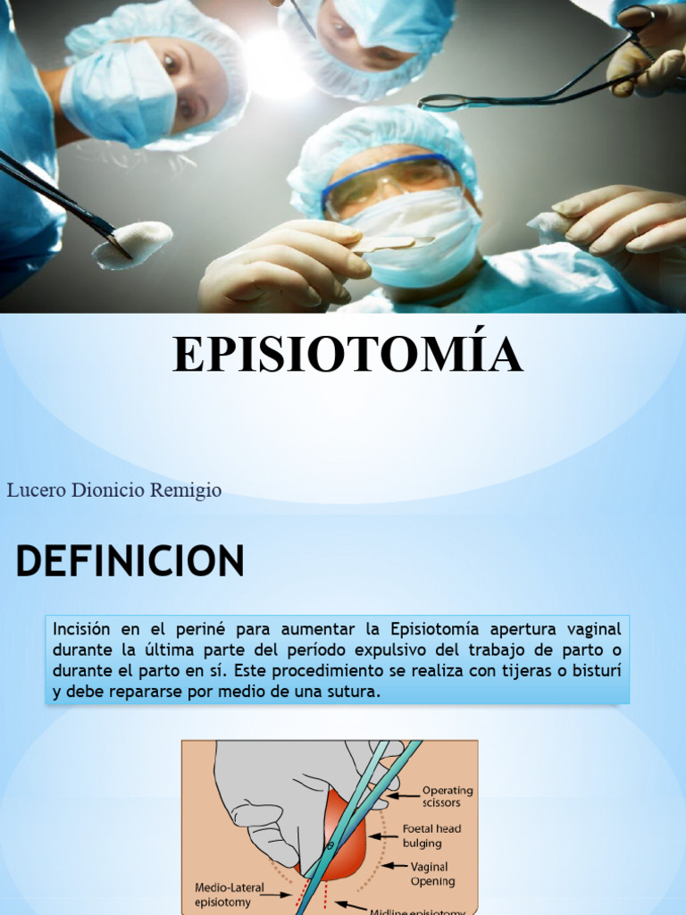 Episiotomía: Tipos y Técnicas Quirúrgicas | PDF | Parto | Vagina