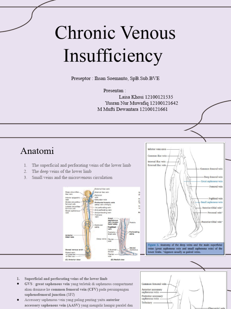 Insufisiensi Vena Kronis: Gejala dan Pengobatan | PDF