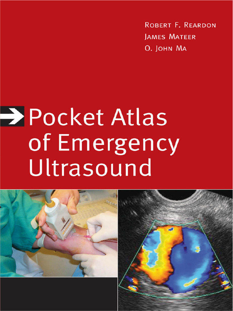 Pocket Atlas of Emergency Ultrasound | PDF