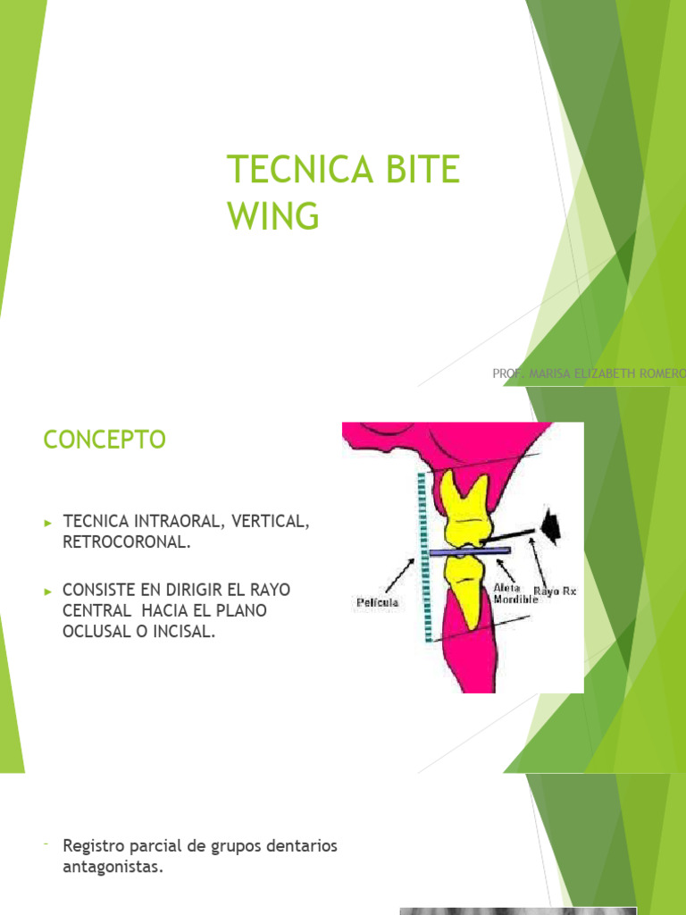 Bite Wing | PDF