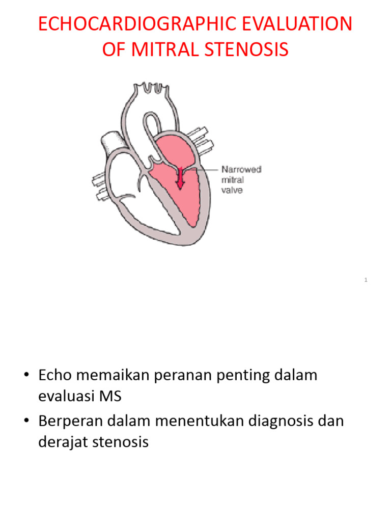 5a. Echo Evaluation of Mitral Stenosis, DR Azri | PDF | Angiology | Clinical Medicine