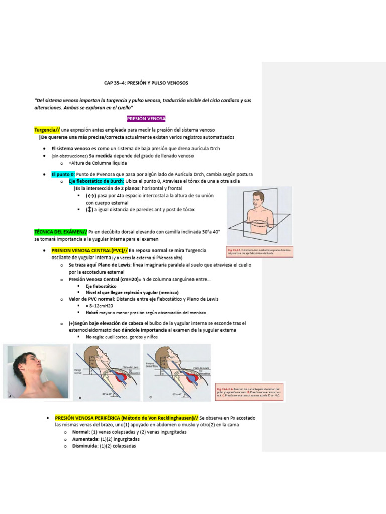 Cap 35-4 Presión y Pulso Venosos | PDF | Ventrículo (corazón) | Vena