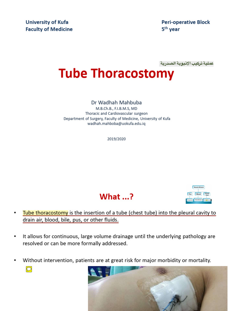 Tube Thoracostomy | PDF | Medical Specialties | Clinical Medicine