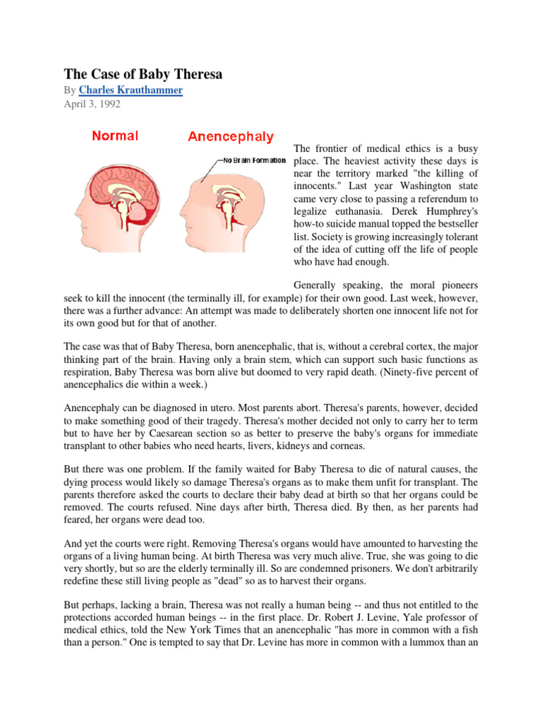 The Case of Baby Theresa | PDF | Organ Transplantation | Infants