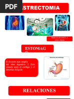 Gastrectomía Parcial | PDF | Estómago | Abdomen