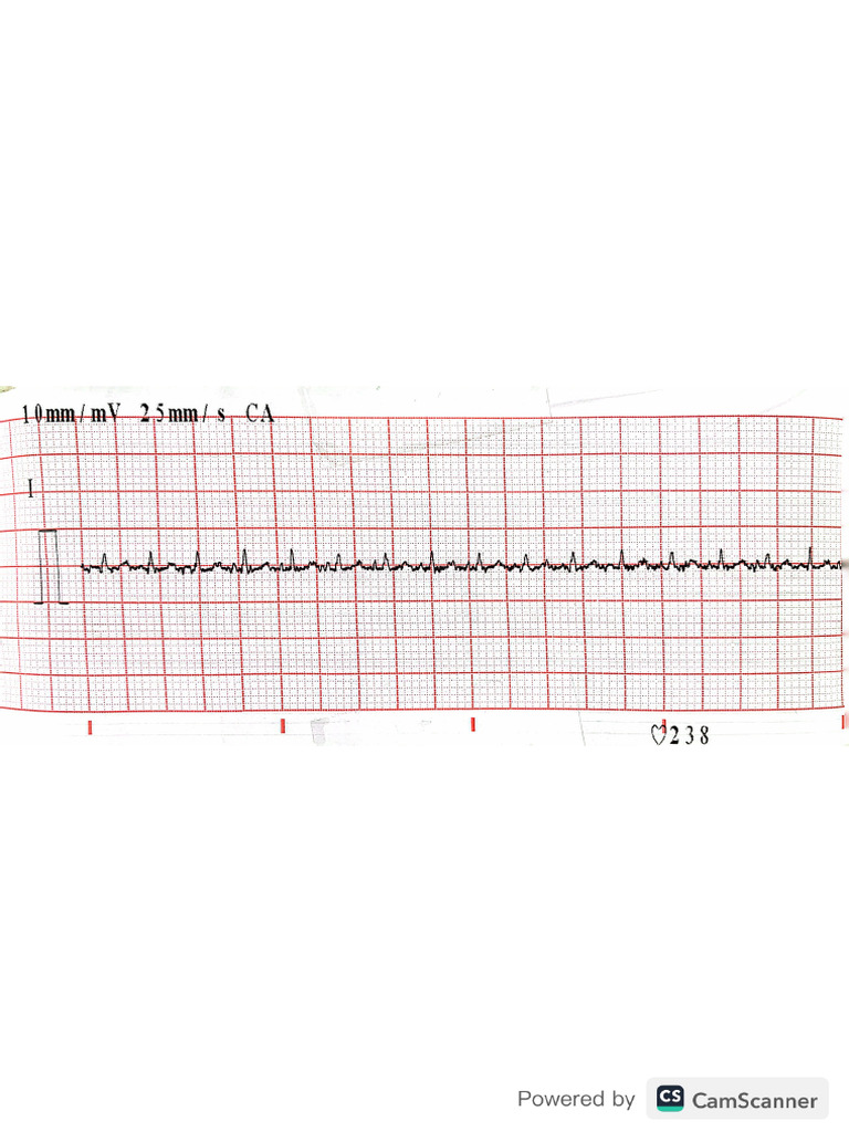 ECG Gato 25mm | PDF
