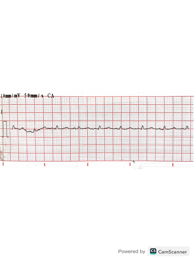 ECG Gato 50mm | PDF