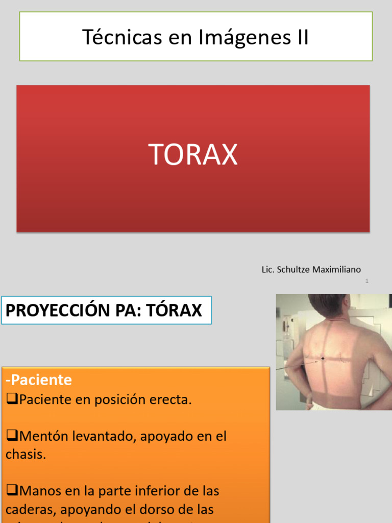 Proyección PA y Lateral del Tórax | PDF | Pulmón | Tórax