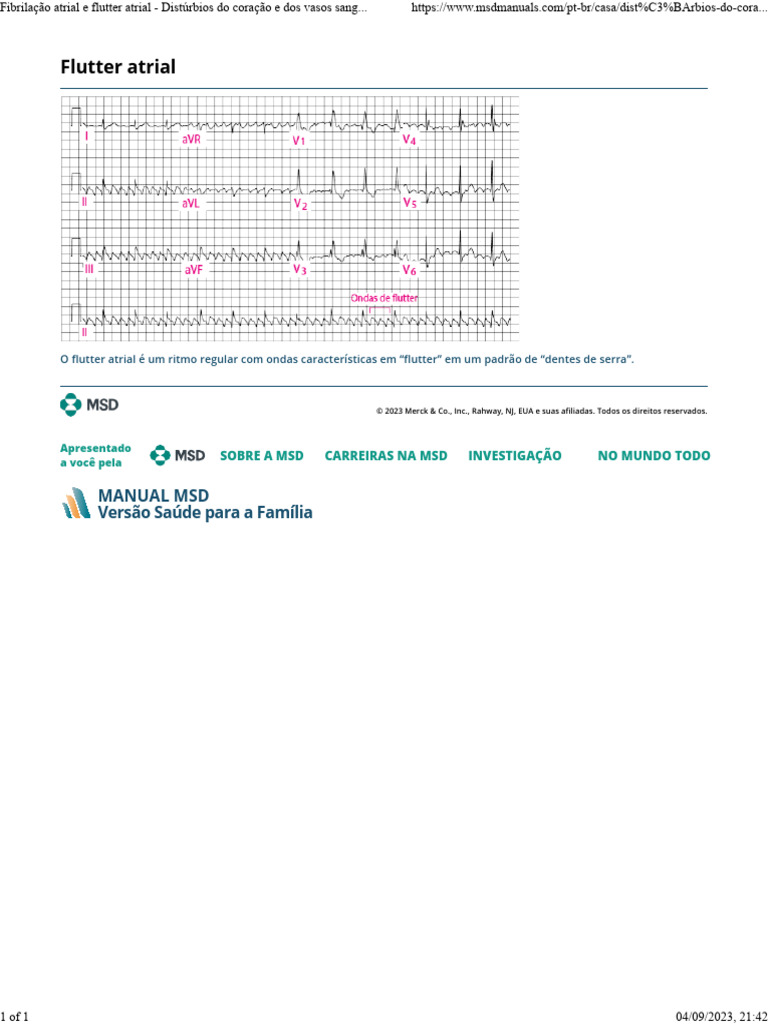 Fibrilação Atrial e Flutter Atrial - Distúrbios Do Coração e Dos Vasos ...