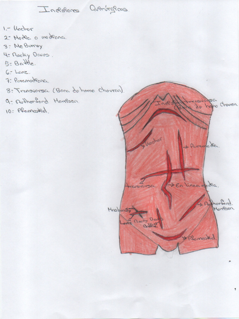Incisiones Quirúrgicas | PDF