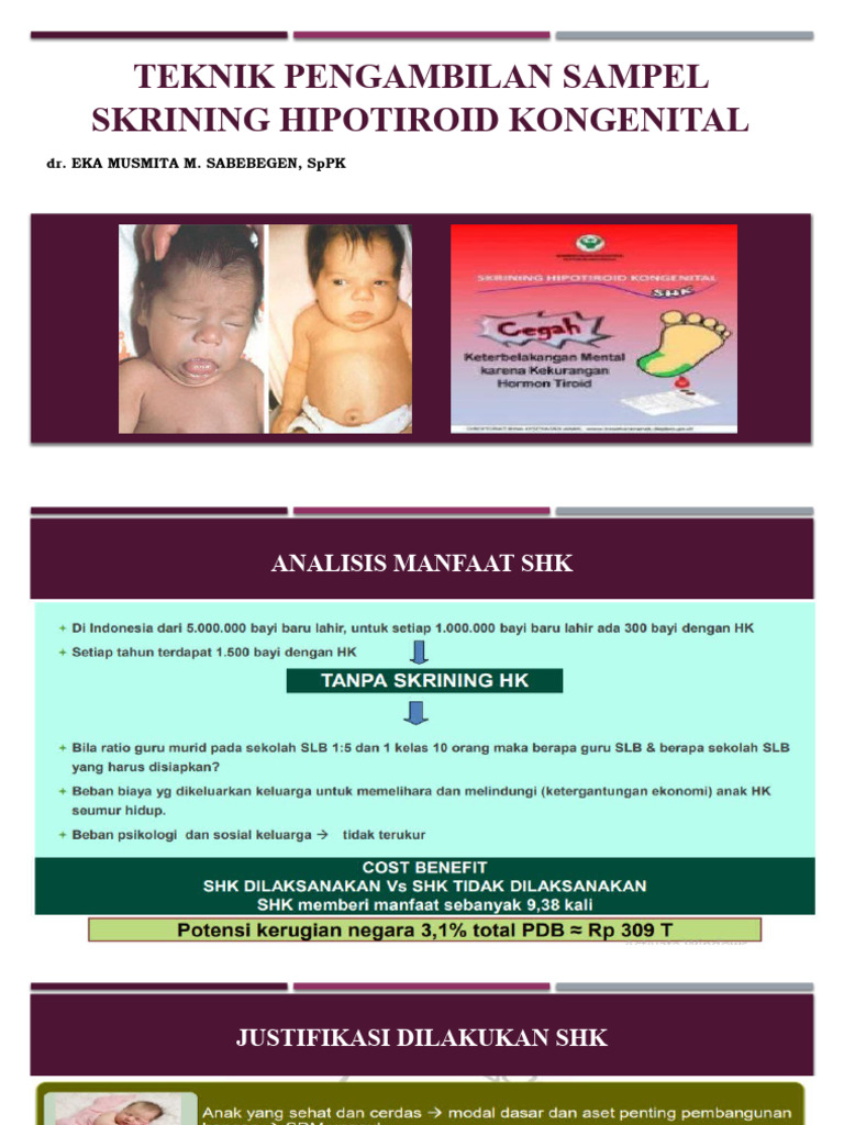 Skrining Hipotiroid Kongenital Eka | PDF