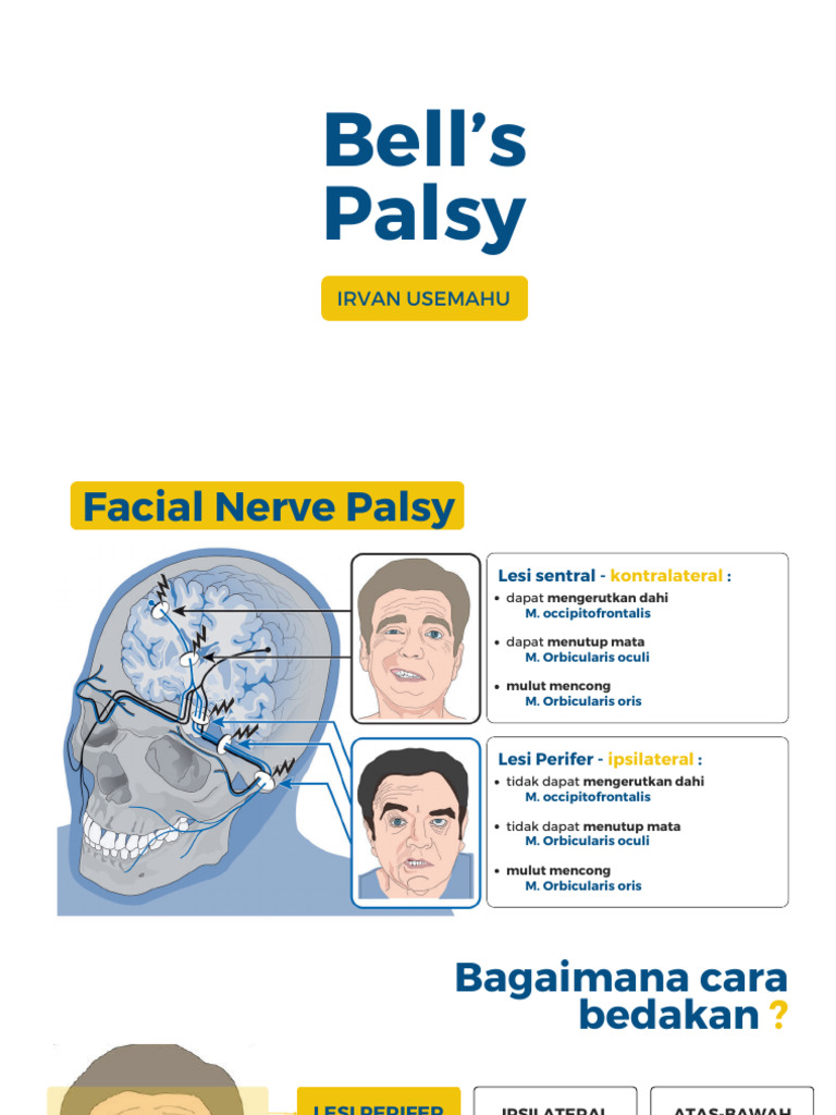 Bells Palsy NDNE | PDF