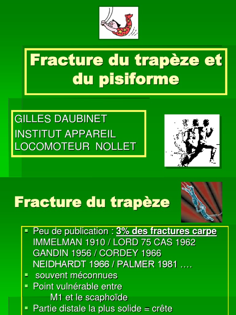 POIGNET Fracture Du Trapèze Et Du Pisiforme | PDF | Articulation ...