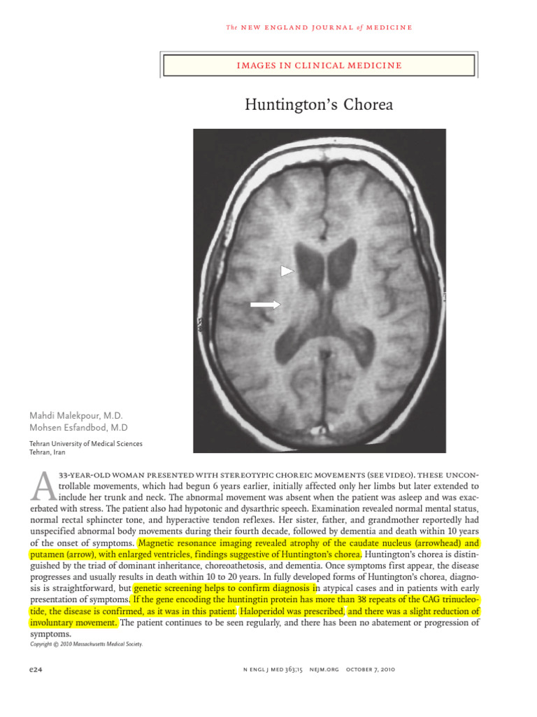 Huntingtons Chorea | PDF