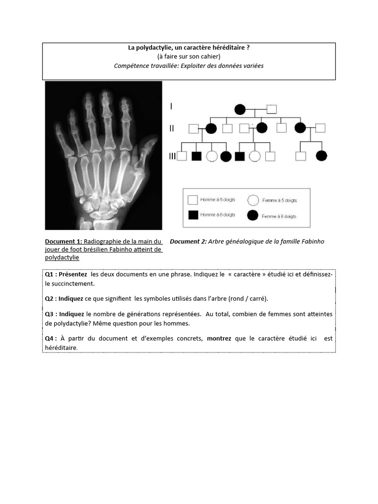 Polydactylie : Hérédité et Transmission | PDF