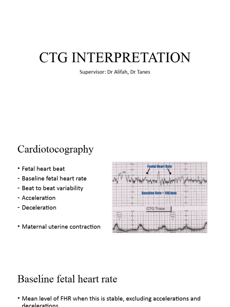 CTG Interpretation 1 | PDF | Heart Rate | Heart