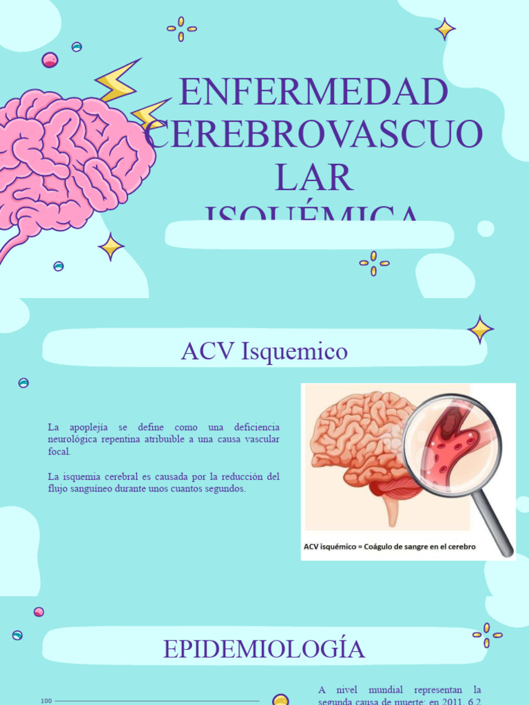 Acv Isquemico | PDF | Carrera | Isquemia