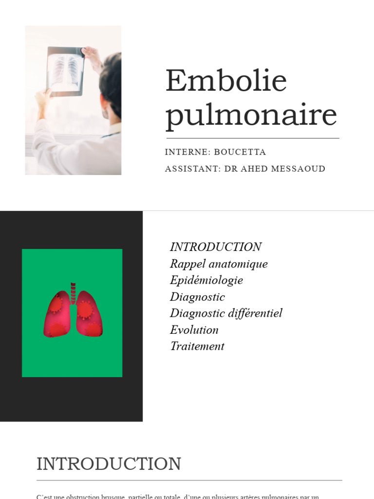 Diagnostic et Traitement de l'Embolie Pulmonaire | PDF | Infarctus du ...