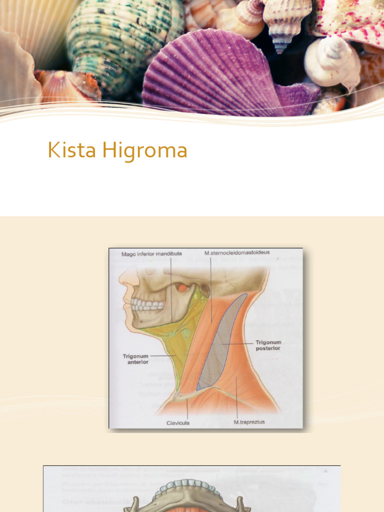 Higroma | PDF