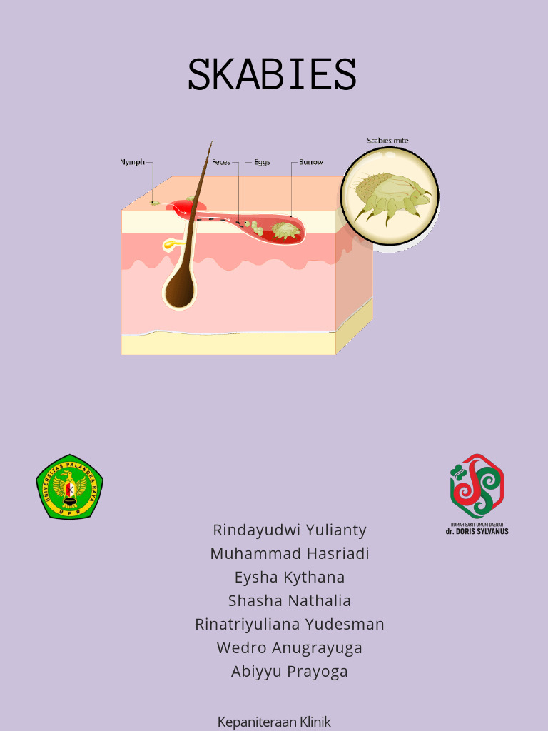 Scabies-1.ppt 20230820 140016 0000 | PDF