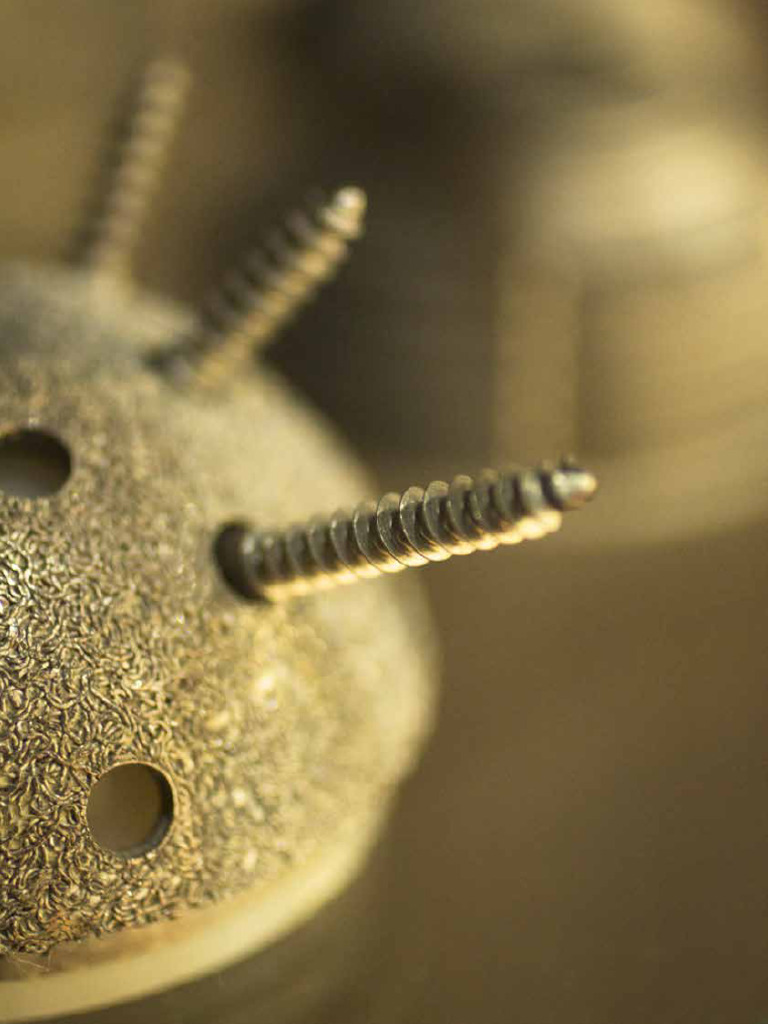 Biomechanics and Biomaterials in Orthopedic Surgery | PDF | Bone ...