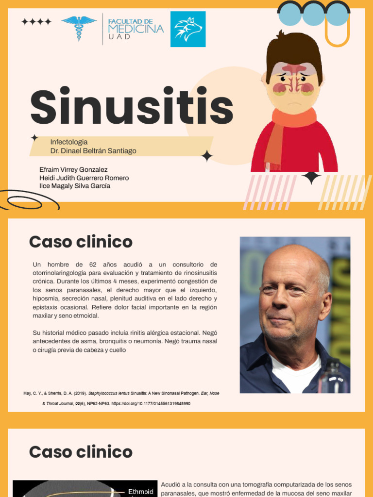 Sinusitis | PDF | Medicina | Especialidades Medicas