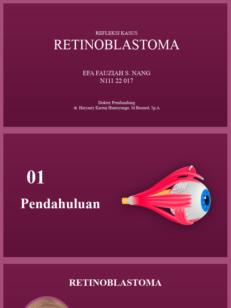 Retinoblastoma | PDF