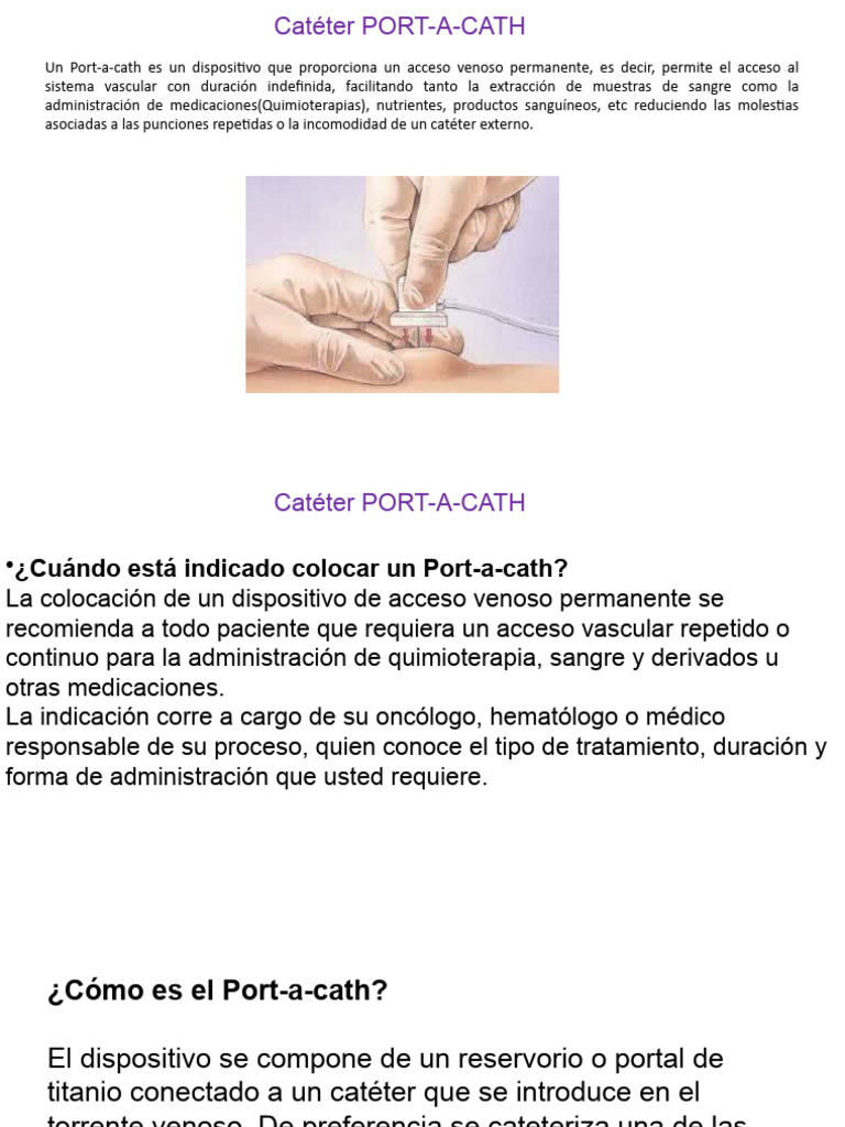 Cateter Port A Cath New | PDF