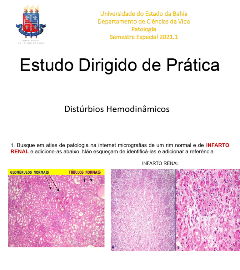 8 - Histologia Do Rim e Infarto Renal | PDF