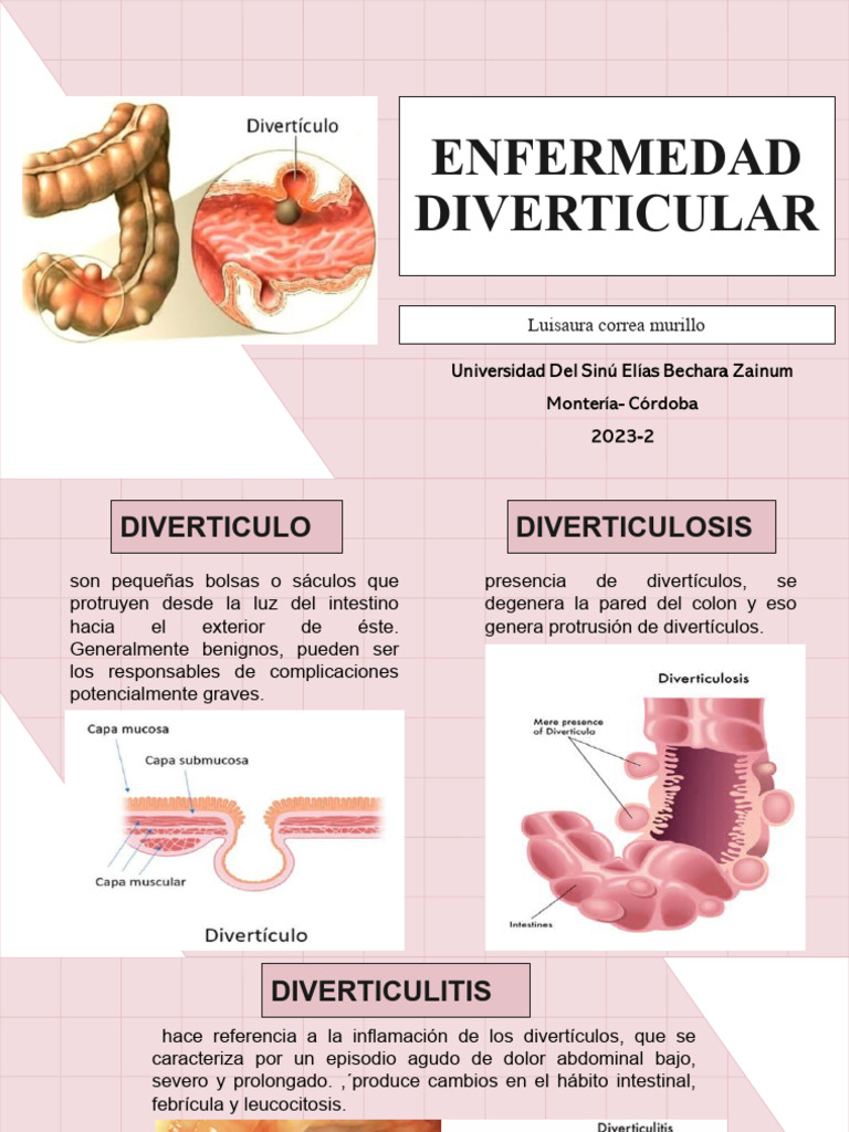 Enfermedad Diverticular: Causas y Tratamiento | PDF | Medicina CLINICA | Enfermedades y trastornos