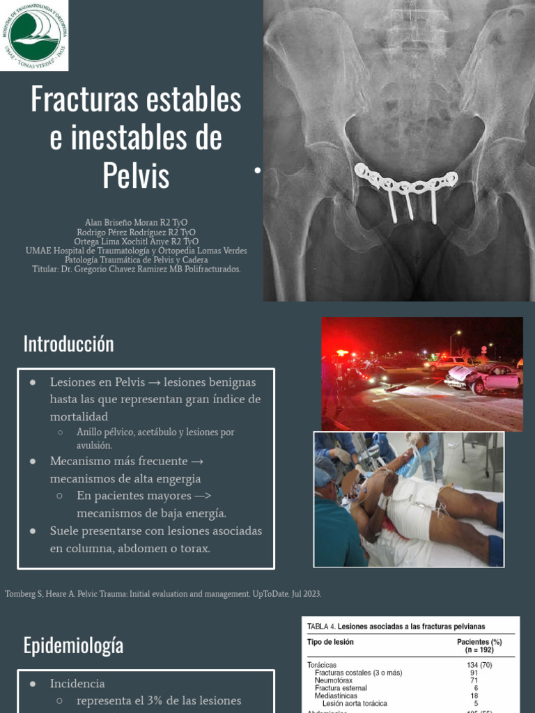 Fracturas Estables e Inestables de Pelvis | Descargar gratis PDF | Pelvis | Sistema ...