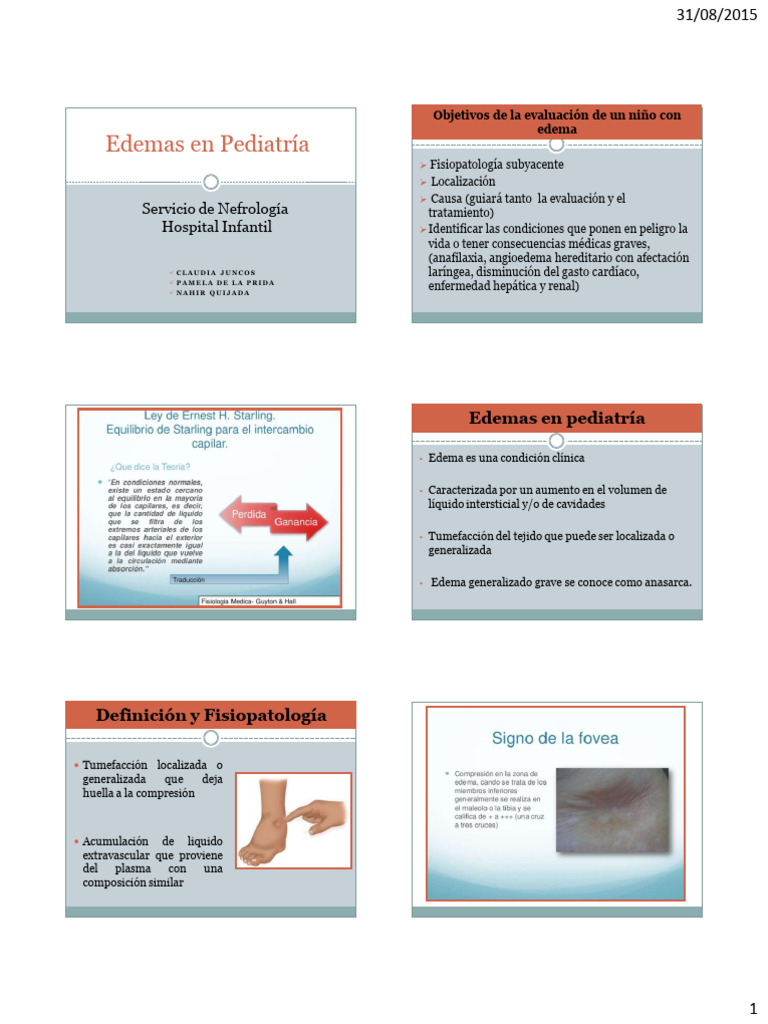 Clase Edemas en Pediatría | PDF | Edema | Enfermedades y trastornos
