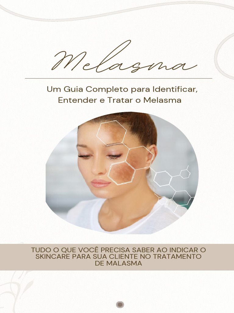 Melasma Torne-se Uma Referência No Tratamento Com Nossas Fórmulas ...