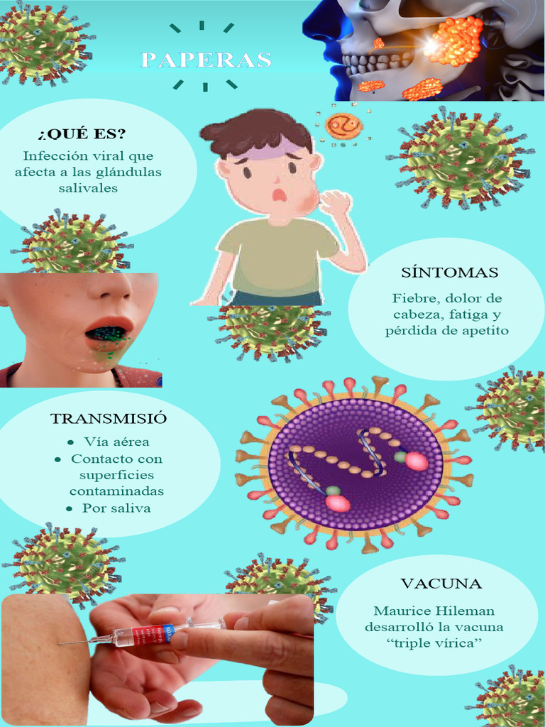 Infografía 11 - PAPERAS | PDF